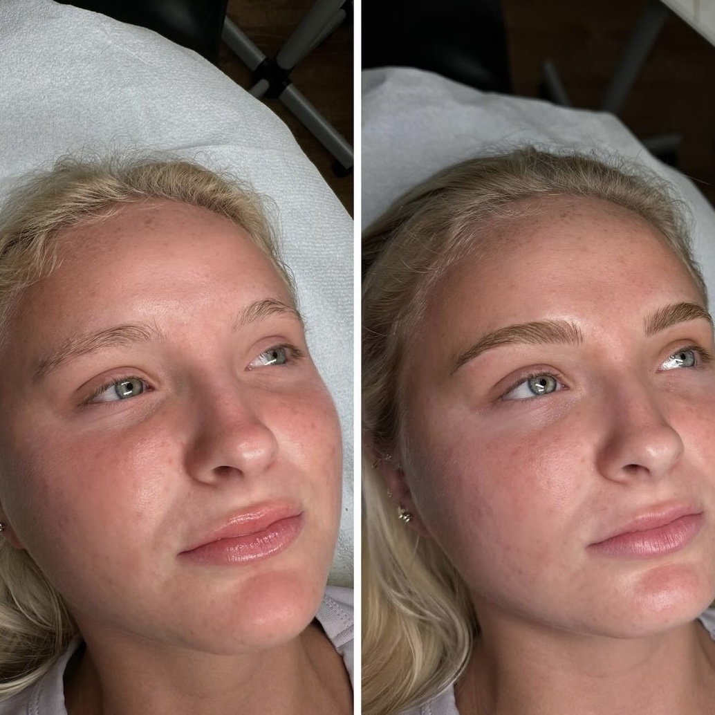 Permanent Makeup For Brows in Pittsburgh, PA | My Cosmetic Solutions